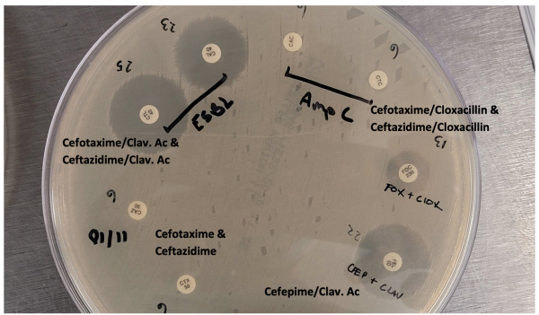 5 Important Things To Know About Extended Spectrum Beta-Lactamases ...